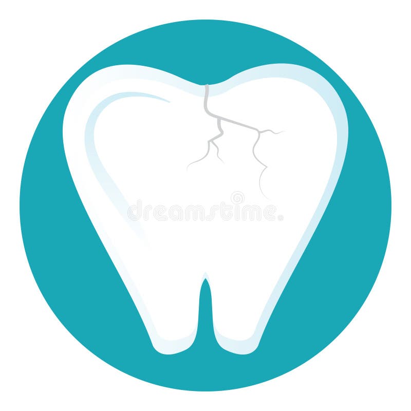 Cracked Tooth. Vector Illustration Decorative Design Stock Vector ...