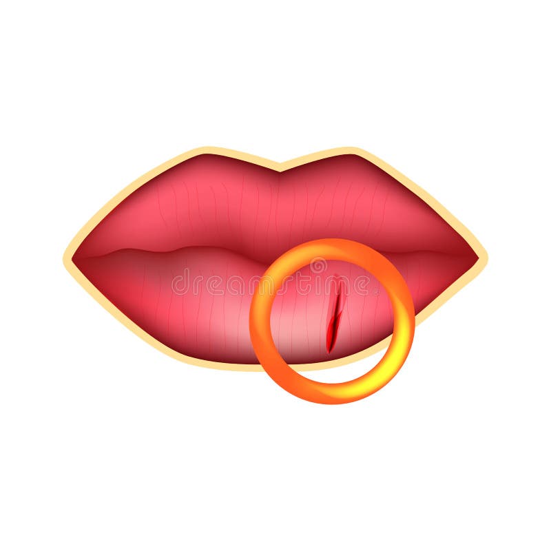 Chapped Lips stock vector. Illustration of sketch, isolated - 46776753