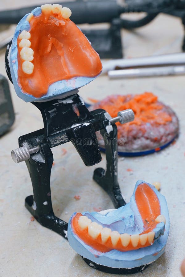 Detailed Denture Model Showcasing Craftsmanship in Dental Design ...
