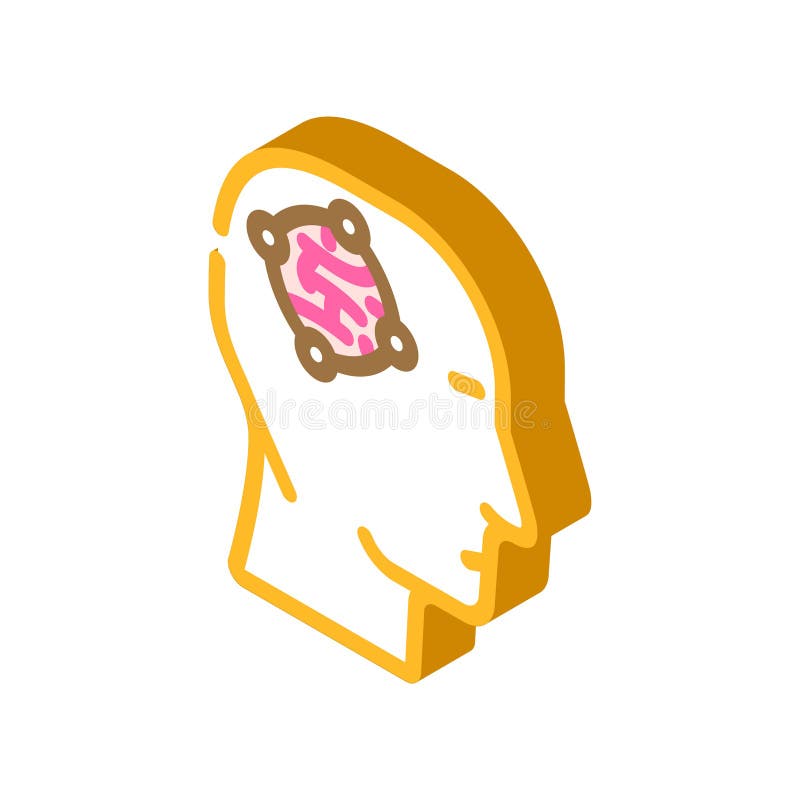 Craniotomy Surgery Isometric Icon Vector Illustration Stock ...