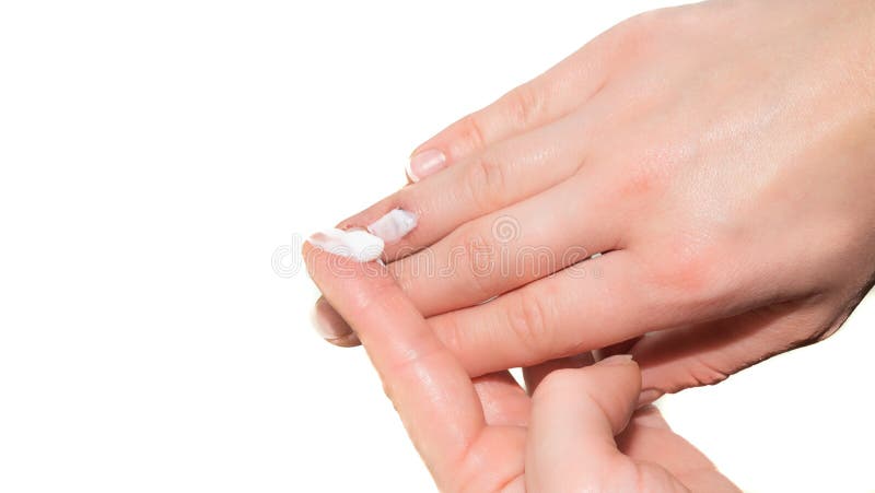 Cream Cures Burns, First Aid, Scalded Wound, Applying Healing Cream on ...