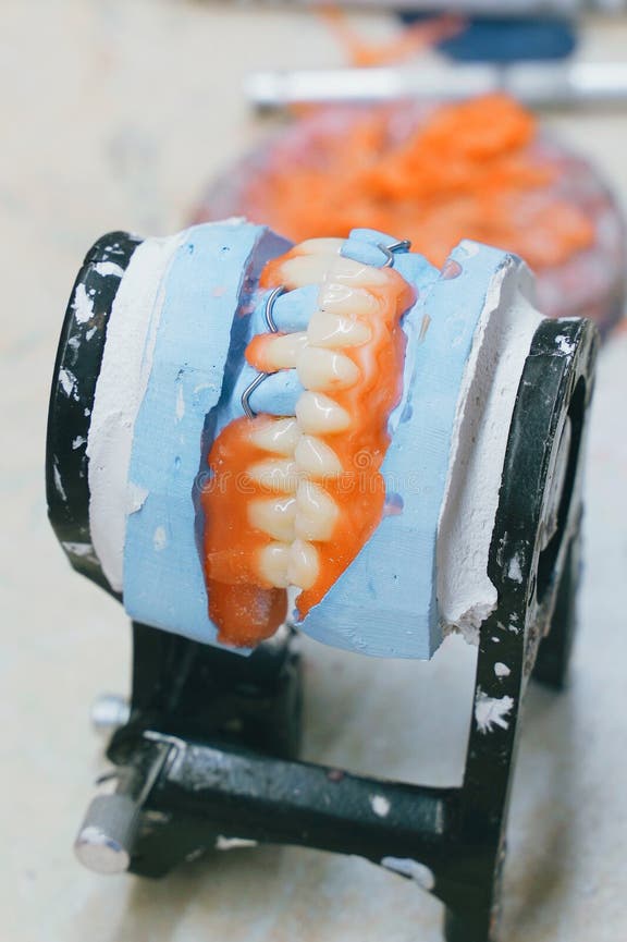 Creating Detailed Denture Models with Precision in a Workshop Stock ...