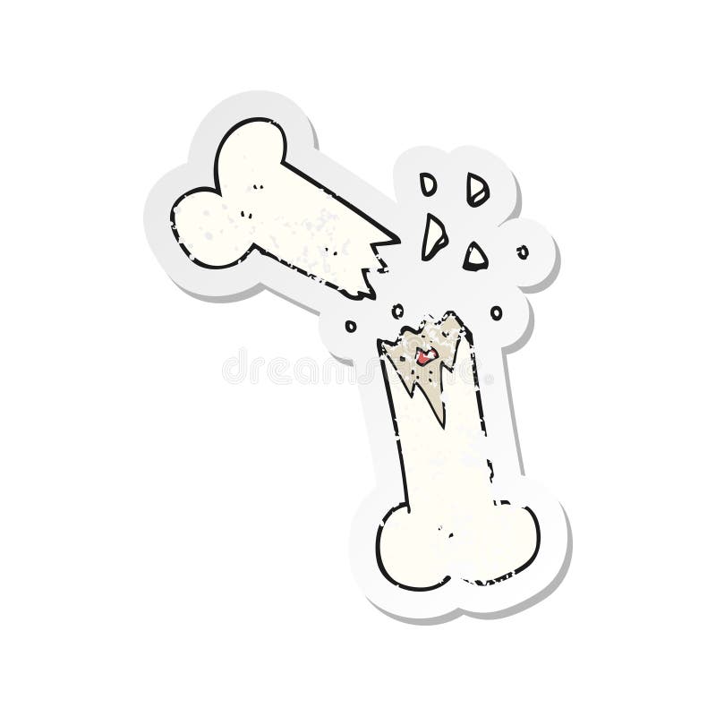 Broken Bone Cartoon Stock Illustrations – 1,462 Broken Bone Cartoon ...