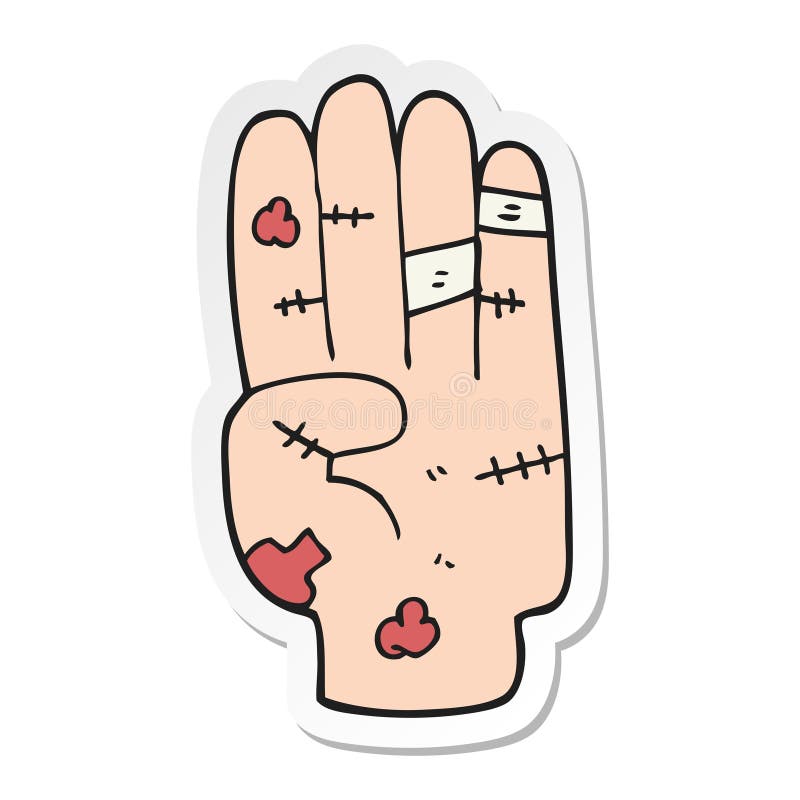 A Creative Sticker of a Cartoon Injured Hand Stock Vector ...