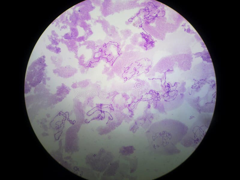 Cromosomas Del Gigante De Los Cromosomas De Polytene Imagen de archivo ...