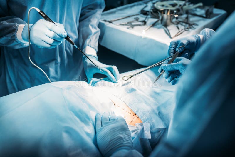 Cropped Image of Surgeons Operating Patient Stock Image - Image of ...