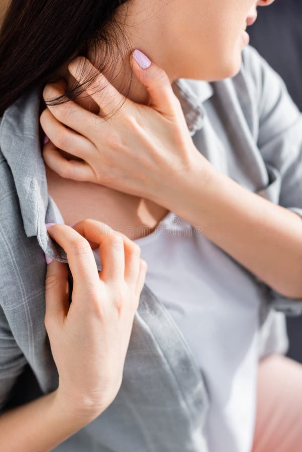 View of Allergic Woman Scratching Neck Stock Image - Image of allergic ...