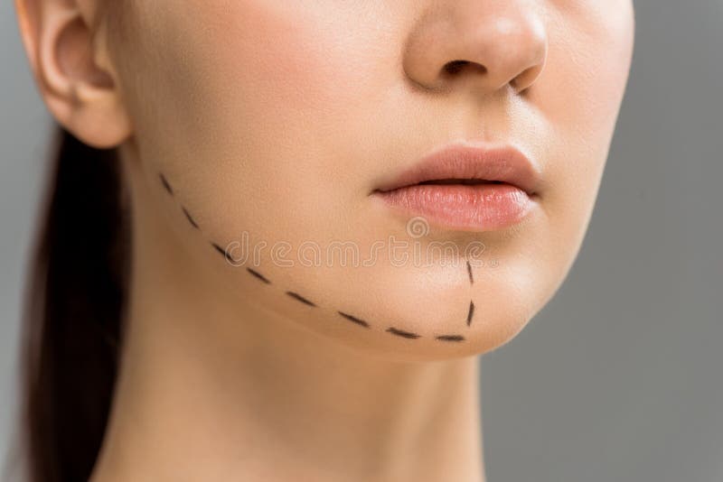 View of Young Woman with Marks on Face Isolated on Grey Stock Photo ...