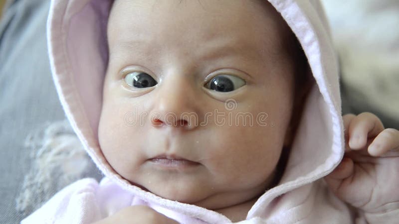 Cross-eyed and Grimacing, a Boy with Strabismus, Portrait of Young Lad ...