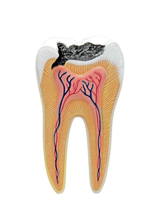 Cross Section of a Anatomical Tooth Model Stock Photo - Image of care ...