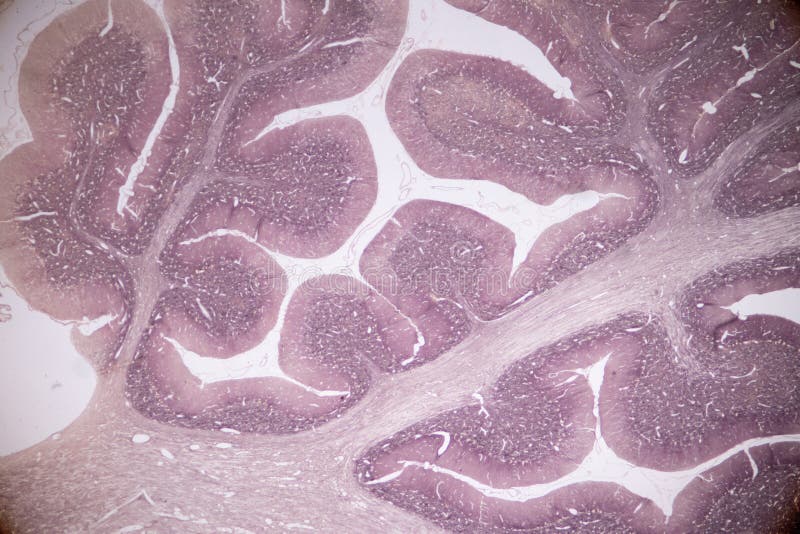 Cross Section of the Cerebellum and Nerve Human Under the Microscope ...