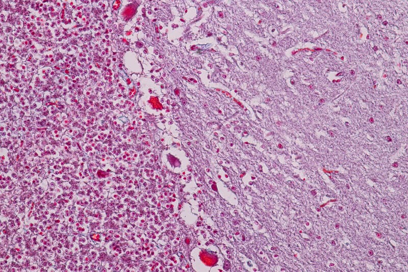 Cross Section of the Cerebellum and Nerve Human Under the Microscope ...