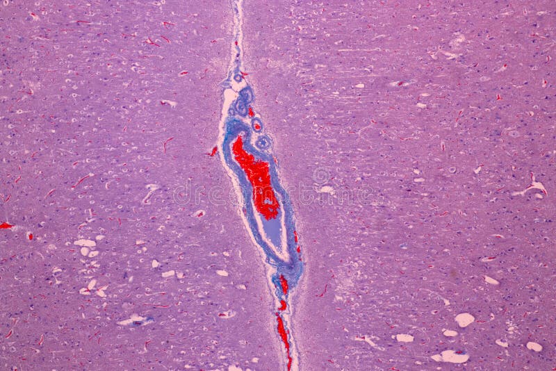 Cross Section of the Cerebellum and Nerve Human Under the Microscope ...