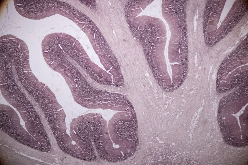 Cross Section of the Cerebellum and Nerve Human Under the Microscope ...