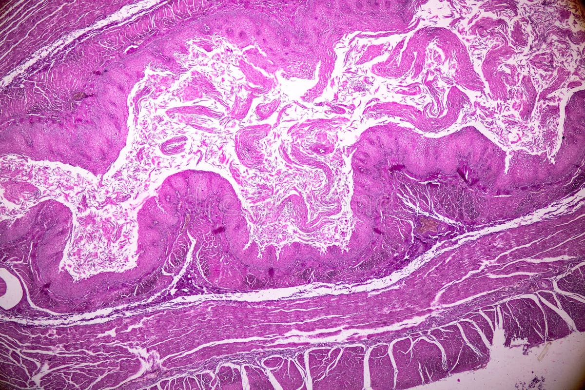 Cerebral Cortex Human Spinal Nerve Motor Neuron Under Microscope Stock ...