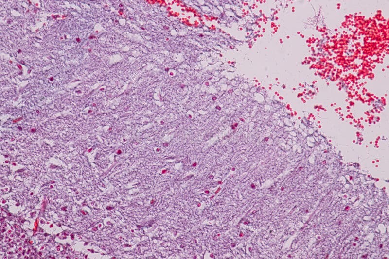 Cross Section Of The Cerebellum And Nerve Human Under The Microscope ...