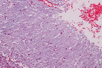 Cerebral Cortex Human Spinal Nerve Motor Neuron Under Microscope Stock ...