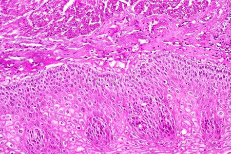 Cerebral Cortex Human Spinal Nerve Motor Neuron Under Microscope Stock ...