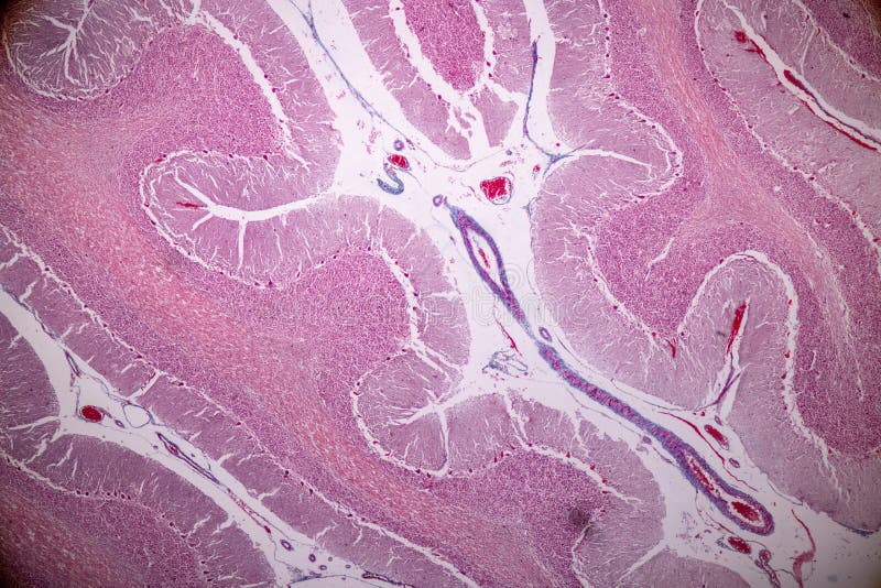Cross Section of the Cerebellum and Nerve Human Under the Microscope ...