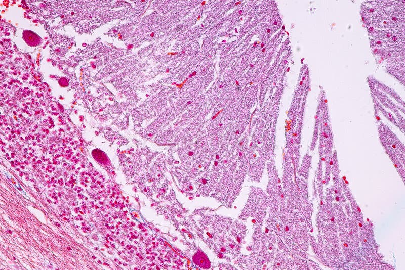 Cross Section of the Cerebellum and Nerve Human Under the Microscope ...