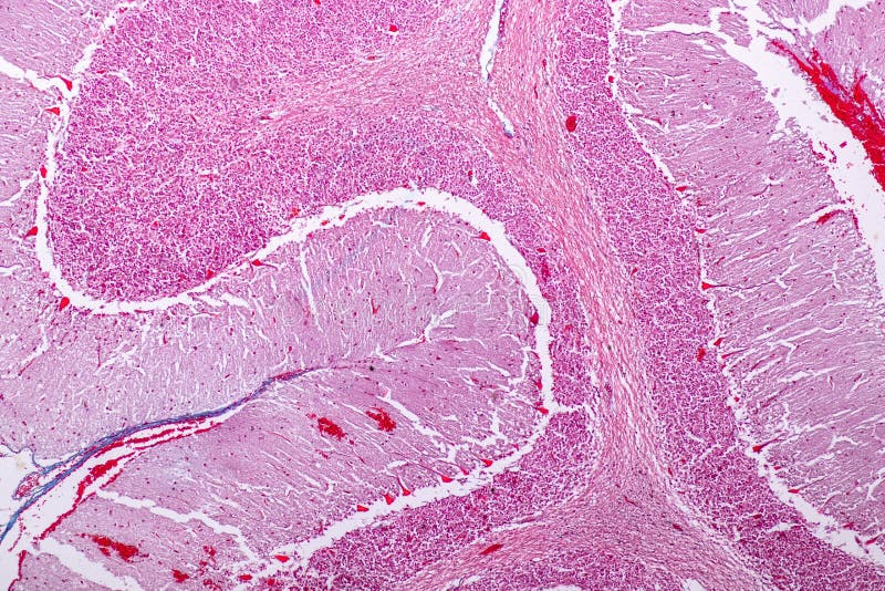 Cross Section of the Cerebellum and Nerve Human Under the Microscope ...