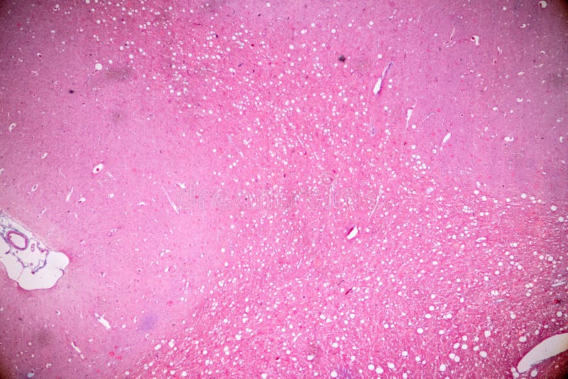 Cross Section of the Cerebellum and Nerve Human Under the Microscope ...