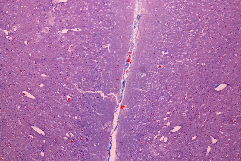 Cross Section of the Cerebellum and Nerve Human Under the Microscope ...