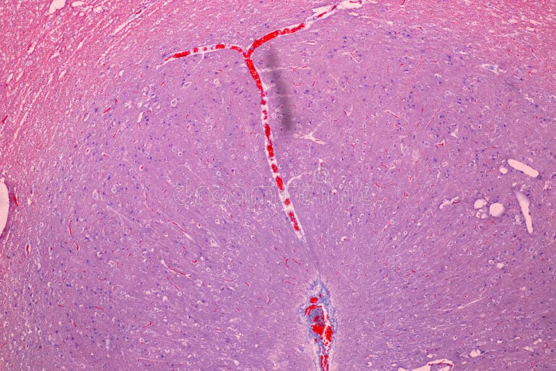 Cross Section of the Cerebellum and Nerve Human Under the Microscope ...