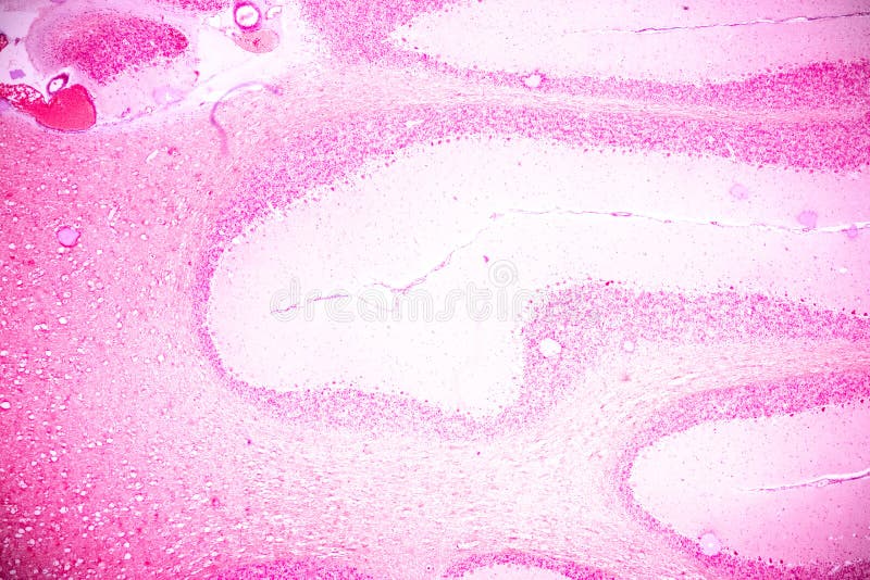 Cross Section of the Cerebellum and Nerve Human Under the Microscope ...