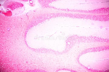 Cerebral Cortex Human Spinal Nerve Motor Neuron Under Microscope Stock ...