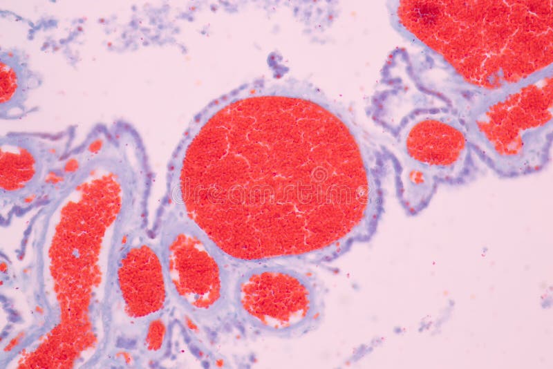 Cross Section of the Cerebellum and Nerve Human Under the Microscope ...