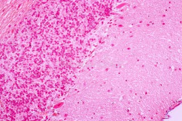 Cerebral Cortex Human Spinal Nerve Motor Neuron Under Microscope Stock ...