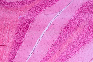 Cerebral Cortex Human Spinal Nerve Motor Neuron Under Microscope Stock ...