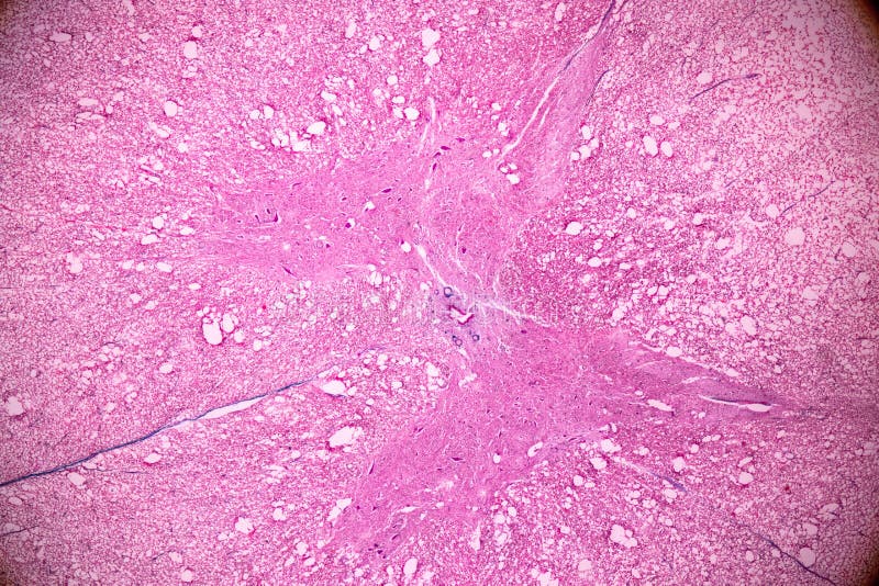 Cross Section of the Cerebellum and Nerve Human Under the Microscope ...
