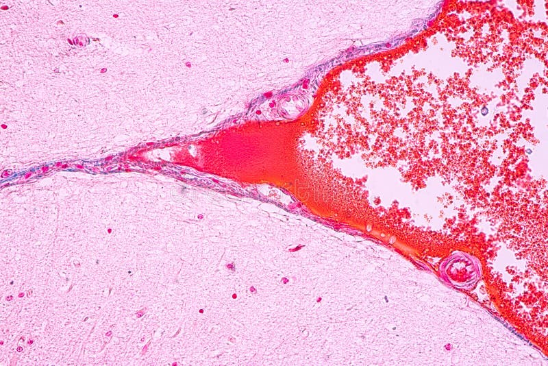 Cross Section of the Cerebellum and Nerve Human Under the Microscope ...