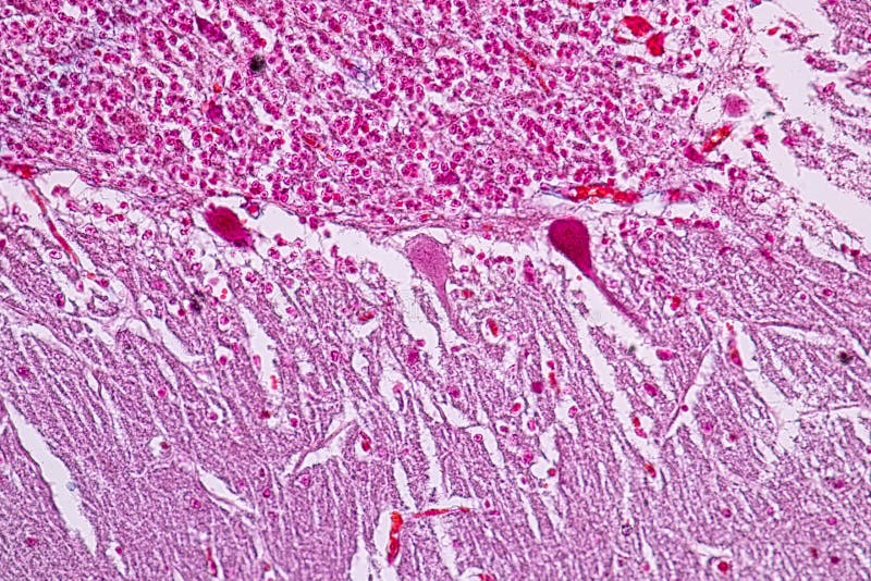 Cross Section of the Cerebellum and Nerve Human Under the Microscope ...