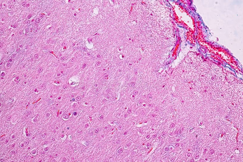 Cross Section of the Cerebellum and Nerve Human Under the Microscope ...
