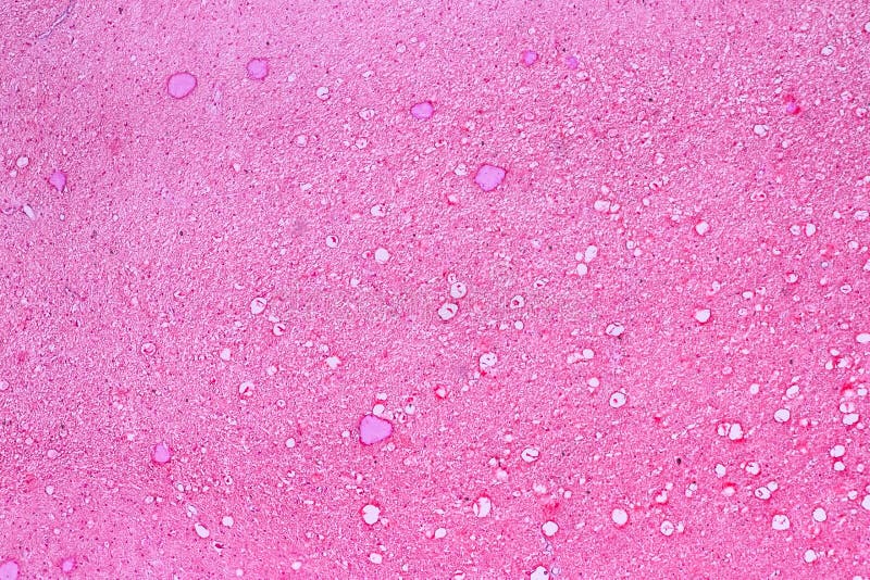 Cross Section of the Cerebellum and Nerve Human Under the Microscope ...