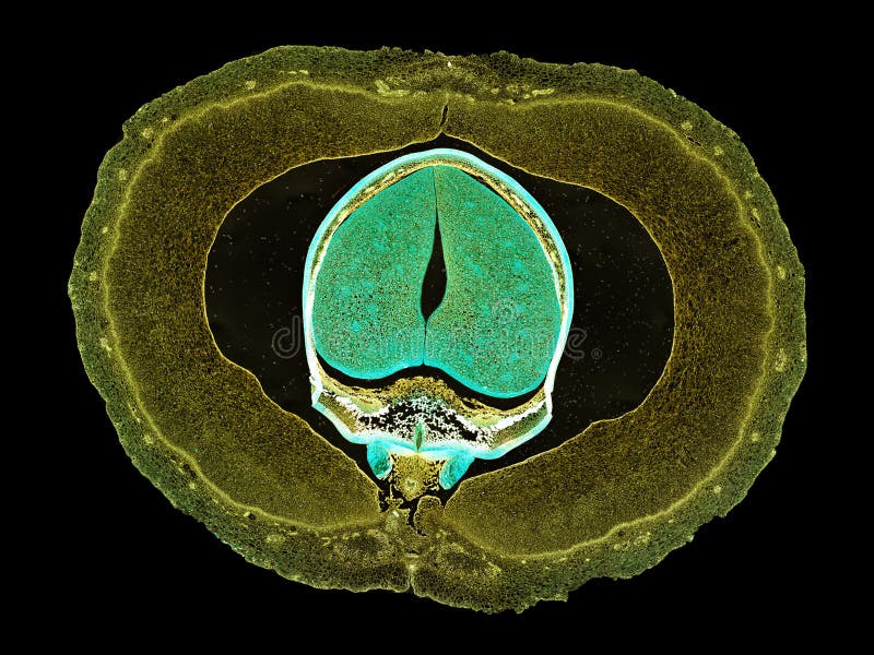 Cross Section Cut of a Plant Stem Under Microscope Stock Photo - Image ...