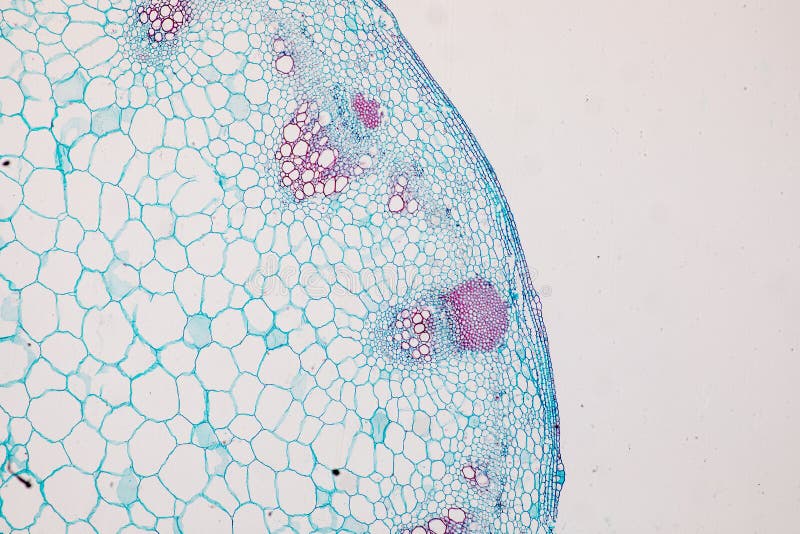 Cross-section Dicot, Monocot and Root of Plant Stem Under the ...