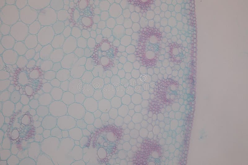 Cross-section Dicot, Monocot and Root of Plant Stem Under the ...
