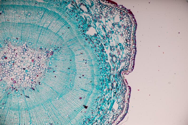 Cross-section Dicot, Monocot and Root of Plant Stem Under the ...