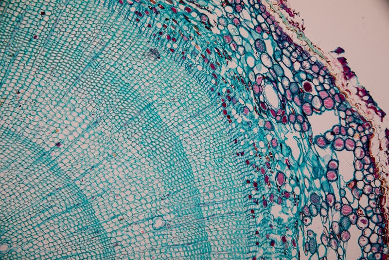 Cross-section Dicot, Monocot and Root of Plant Stem Under the ...