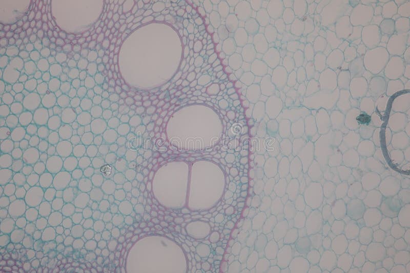 Cross-section Dicot, Monocot and Root of Plant Stem Under the ...