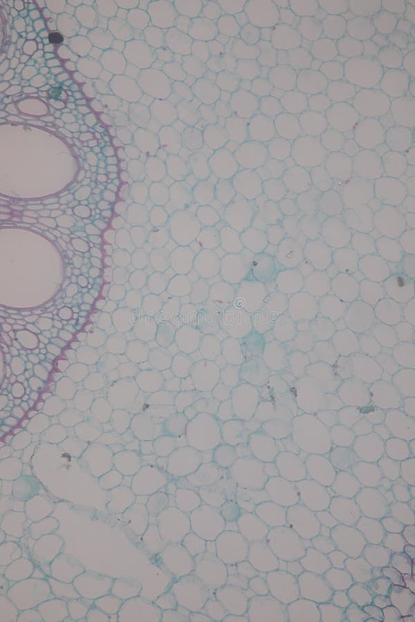 Cross-section Dicot, Monocot and Root of Plant Stem Under the ...