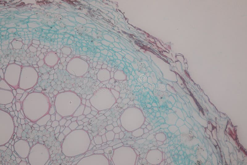 Cross-section Dicot, Monocot and Root of Plant Stem Under the ...