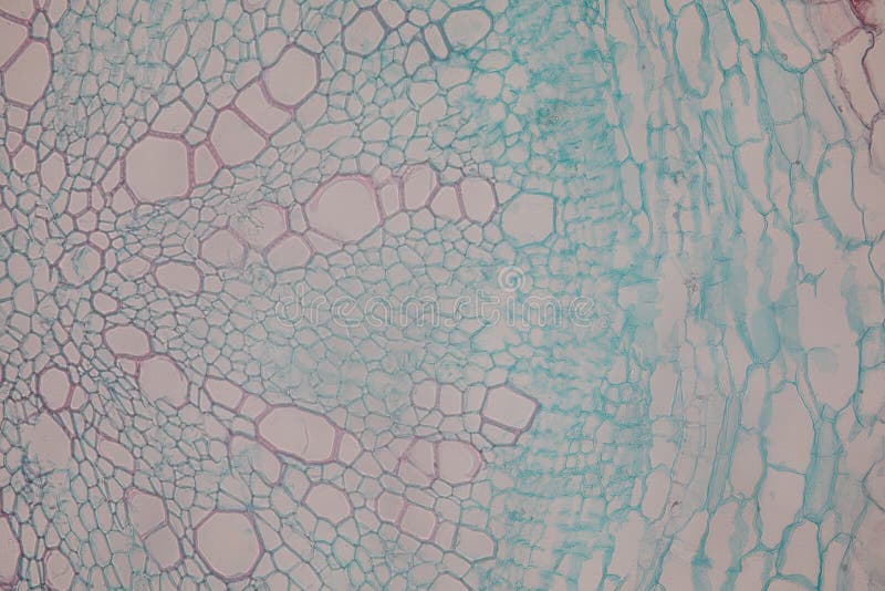 Cross-section Dicot, Monocot and Root of Plant Stem Under the ...