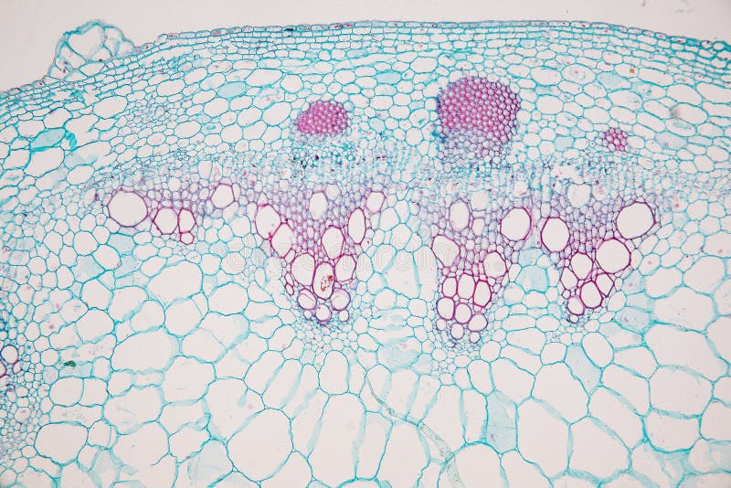 Cross-section Dicot, Monocot and Root of Plant Stem Under the ...