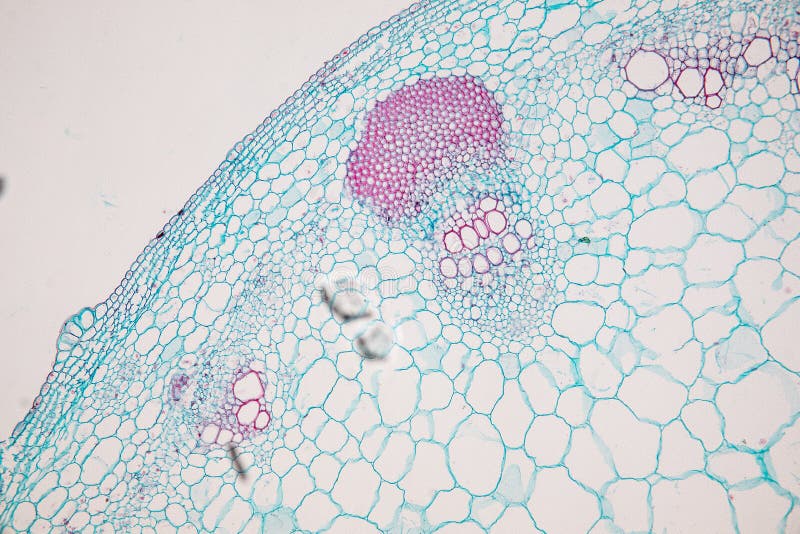 Cross-section Dicot, Monocot and Root of Plant Stem Under the ...