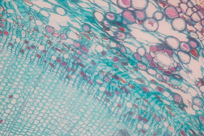 Cross-section Dicot, Monocot and Root of Plant Stem Under the ...